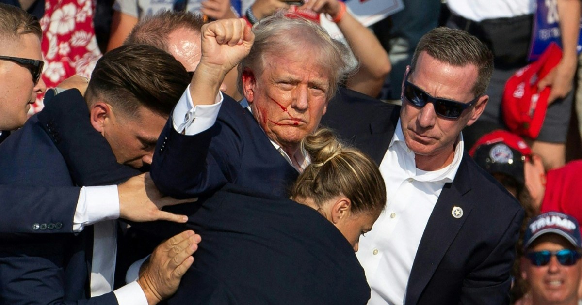 What Happened Between Donald Trump & FBI Director? Bullet Injury Explained